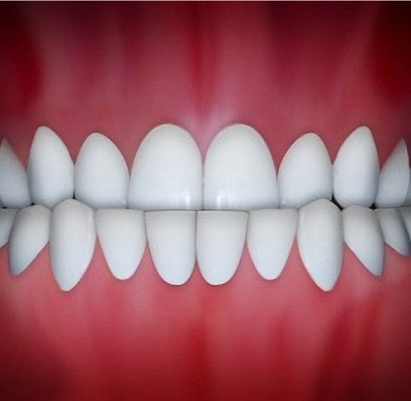 Common Problems | Michael Teichman Orthodontics | Concord,